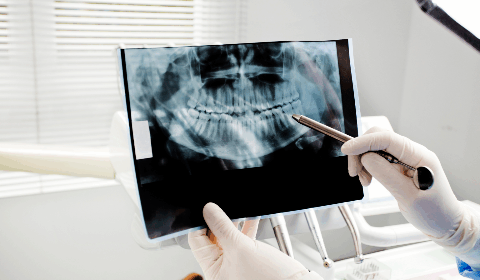 Common Types of Oral Surgery | Bergen Oral Surgery